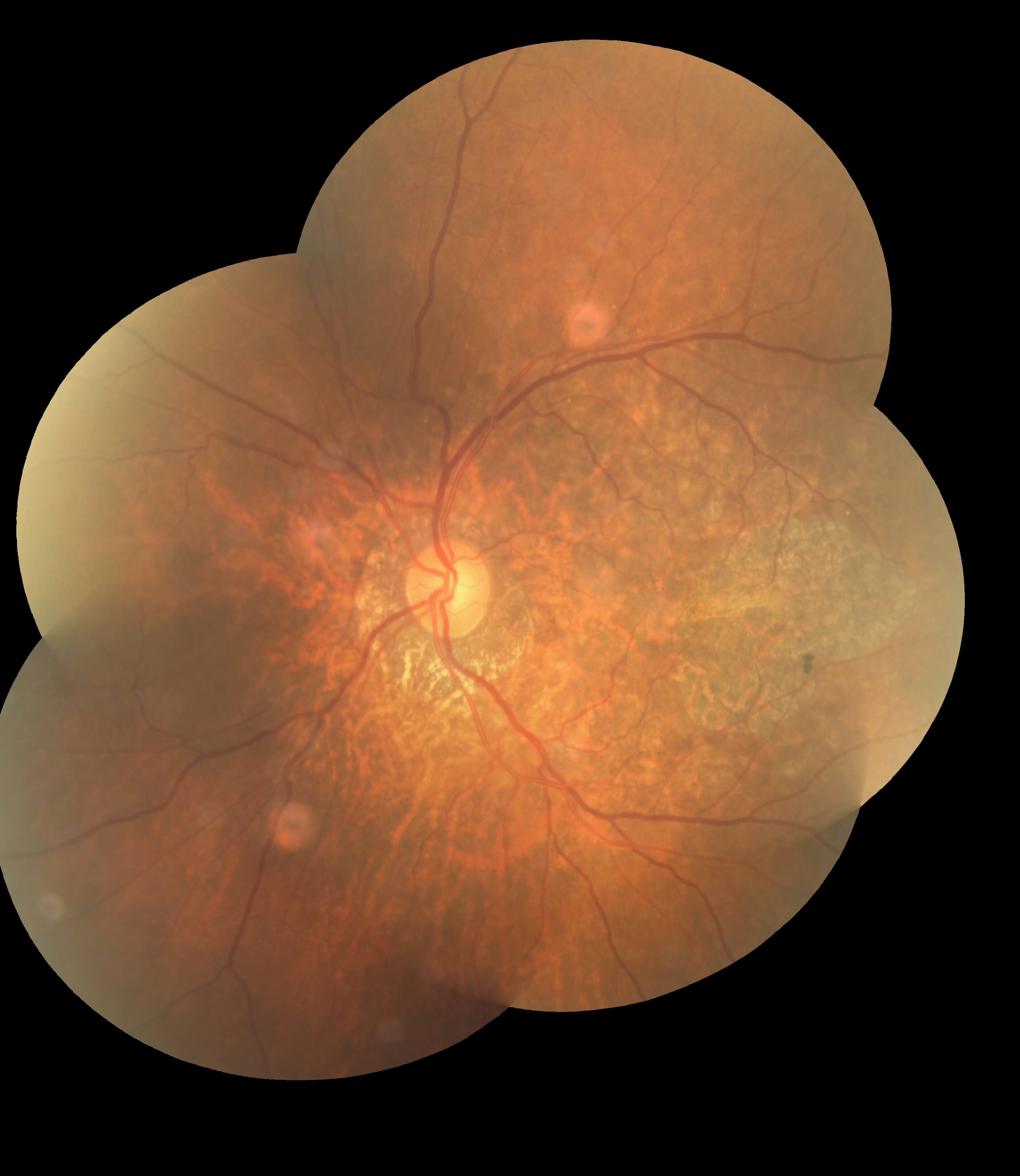 Gallery | Sri Isha Retina Foundation